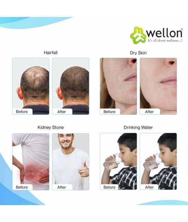 Wellon HydraGuard Domestic Pro Conditioner Device Reduces Hard Water in ...